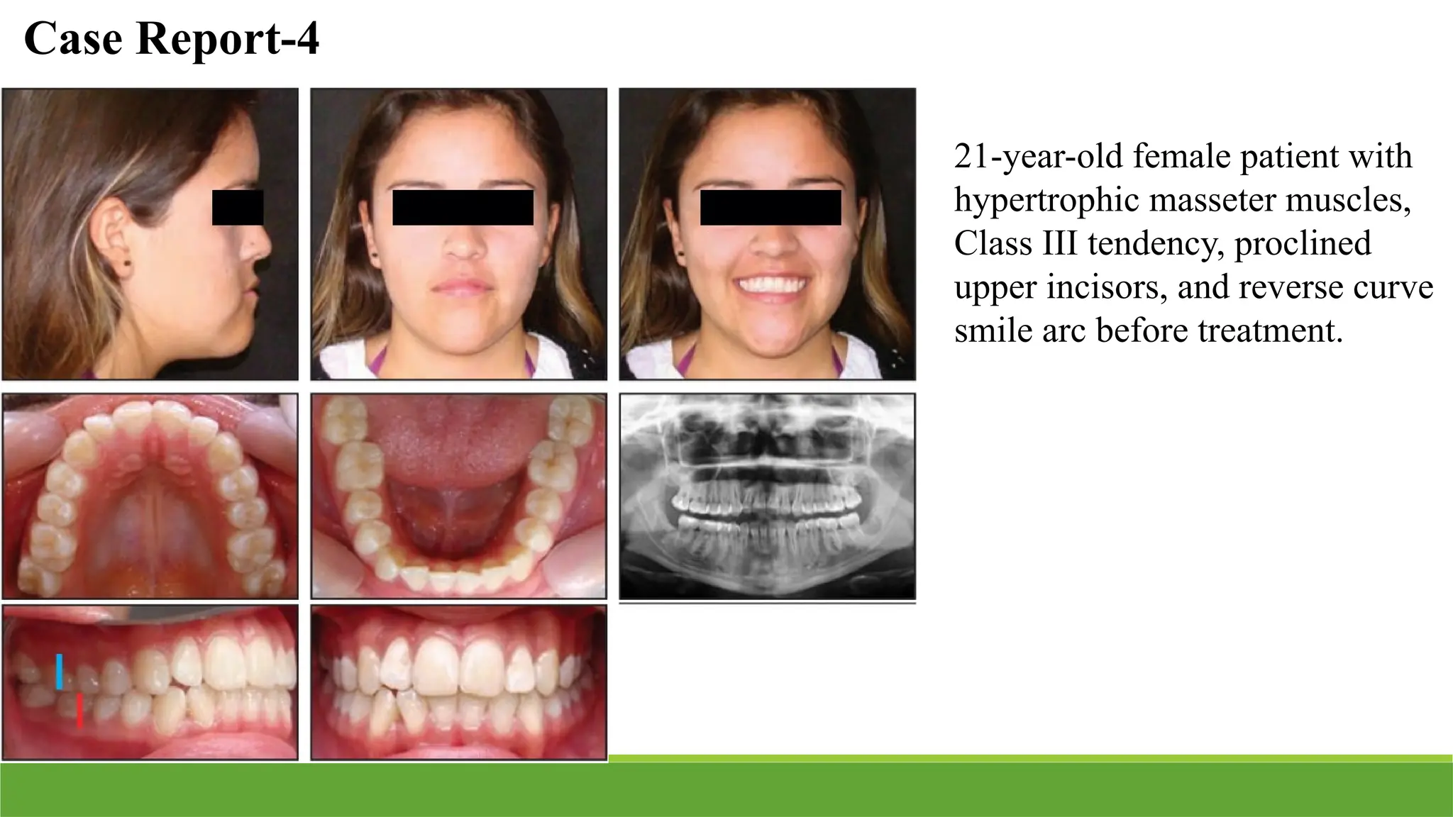 Pitts 21 The 14 Keys to Pitts Case Management.pptx