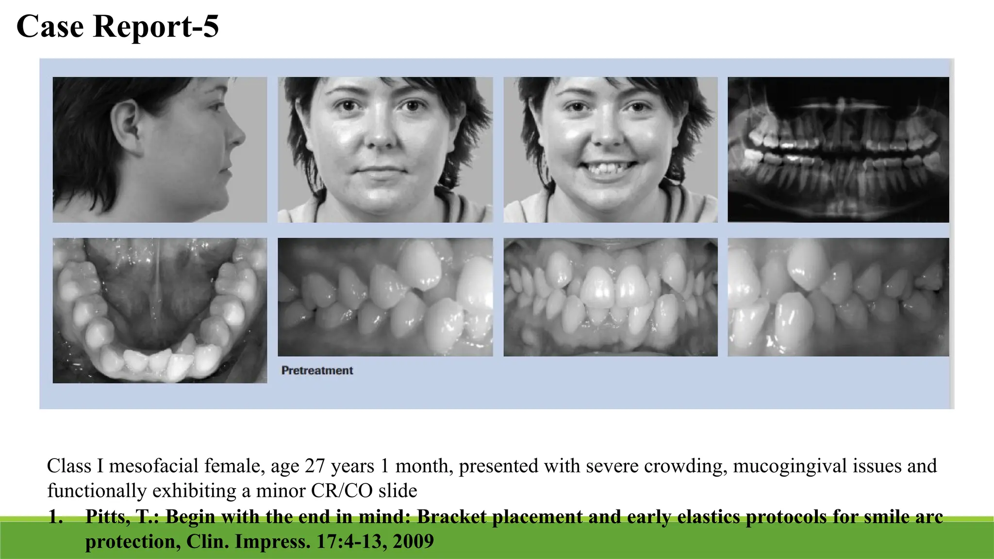 Pitts 21 The 14 Keys to Pitts Case Management.pptx