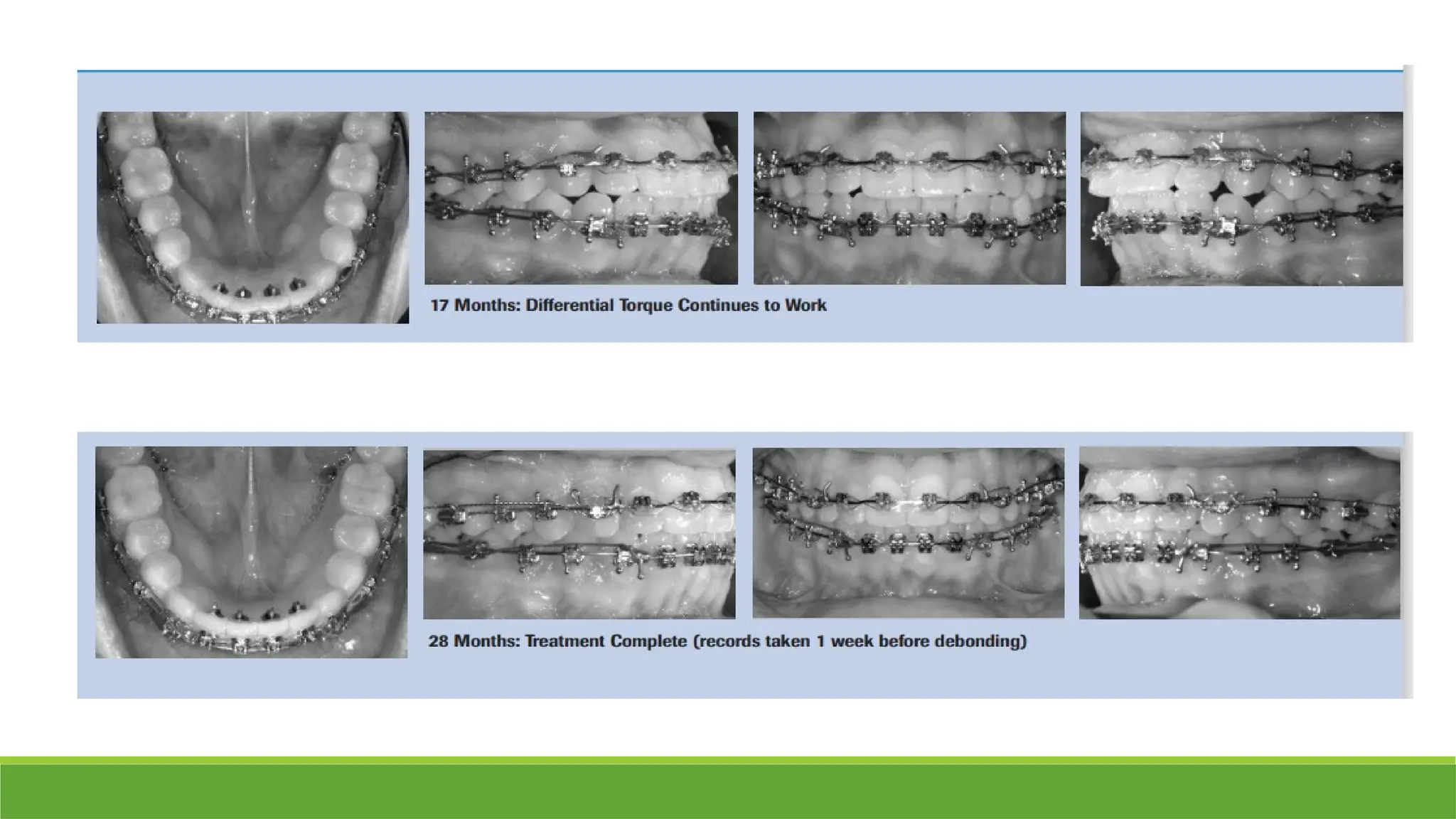 Pitts 21 The 14 Keys to Pitts Case Management.pptx