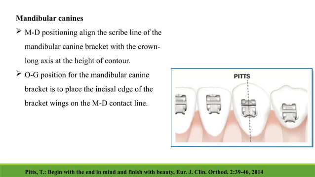 Pitts 21 The 14 Keys to Pitts Case Management.pptx