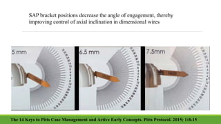Pitts 21 The 14 Keys to Pitts Case Management.pptx