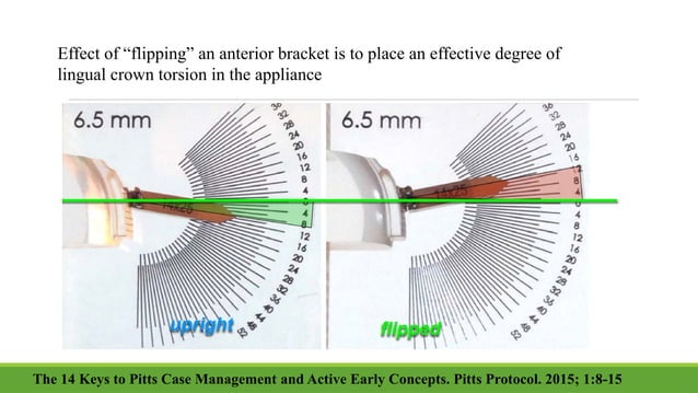 Pitts 21 The 14 Keys to Pitts Case Management.pptx