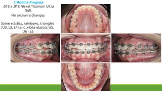 Pitts 21 The 14 Keys to Pitts Case Management.pptx