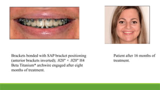 Pitts 21 The 14 Keys to Pitts Case Management.pptx