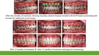 Pitts 21 The 14 Keys to Pitts Case Management.pptx