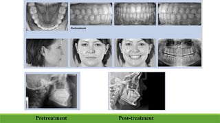 Pitts 21 The 14 Keys to Pitts Case Management.pptx