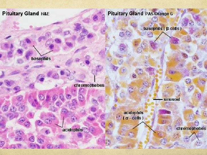 Pituitary