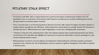 Comprehensive Overview of Pituitary Adenomas: Anatomy, Diagnosis, and ...