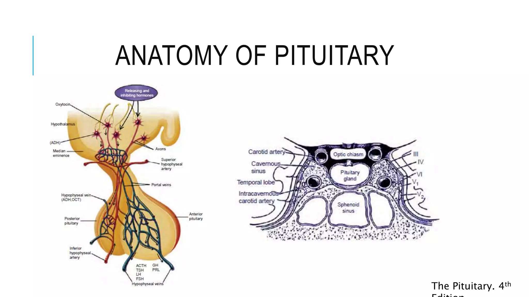 Pituitary apoplexy | PPTX