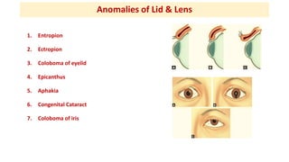 Pituitary & eye | PPT