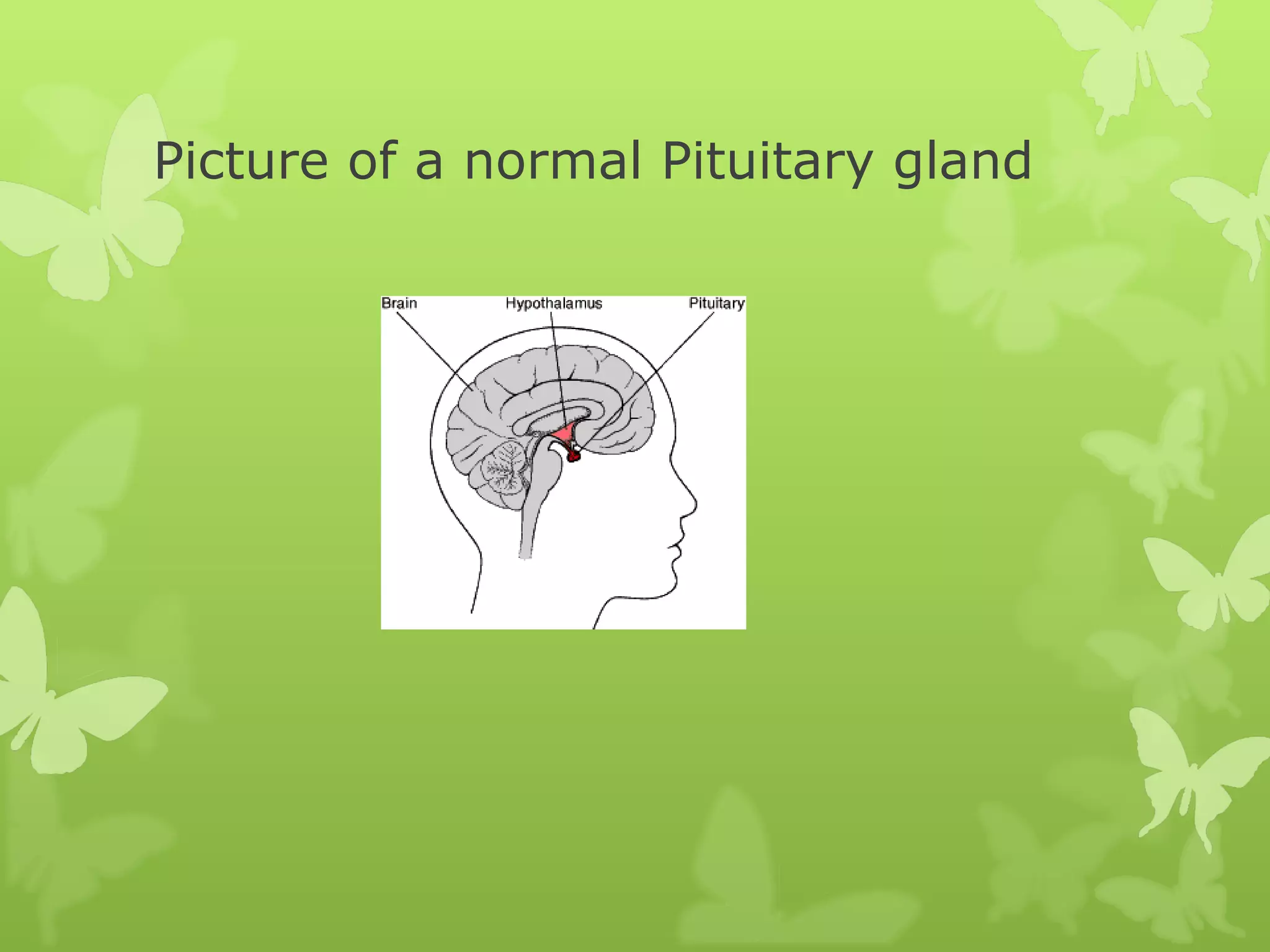 Pituitary gland | PPT