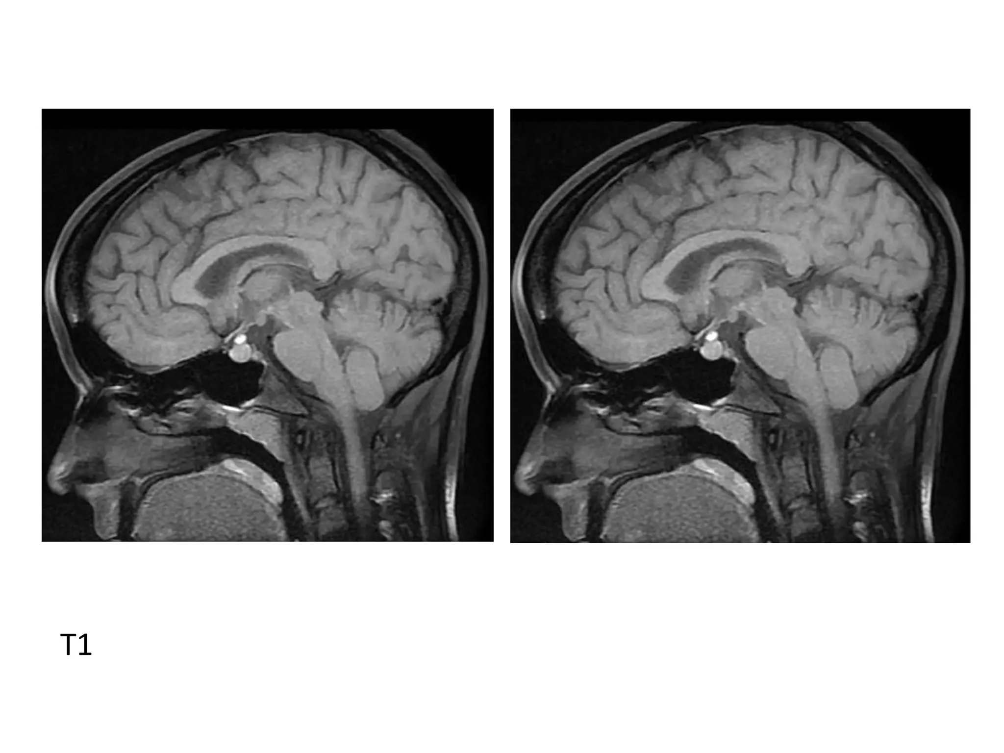 Diagnostic Imaging of the Pituitary Gland | PPT