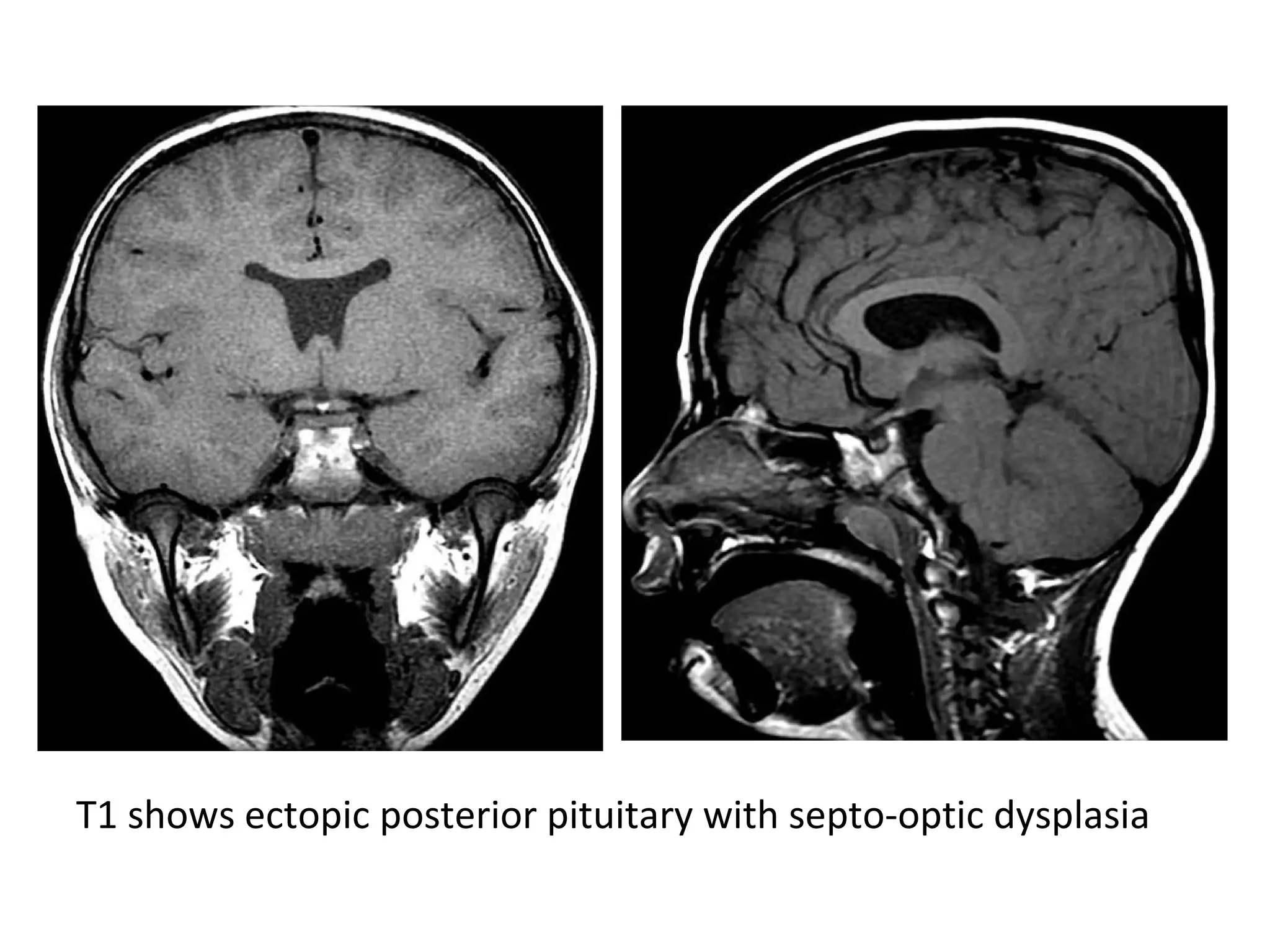 Diagnostic Imaging of the Pituitary Gland | PPT