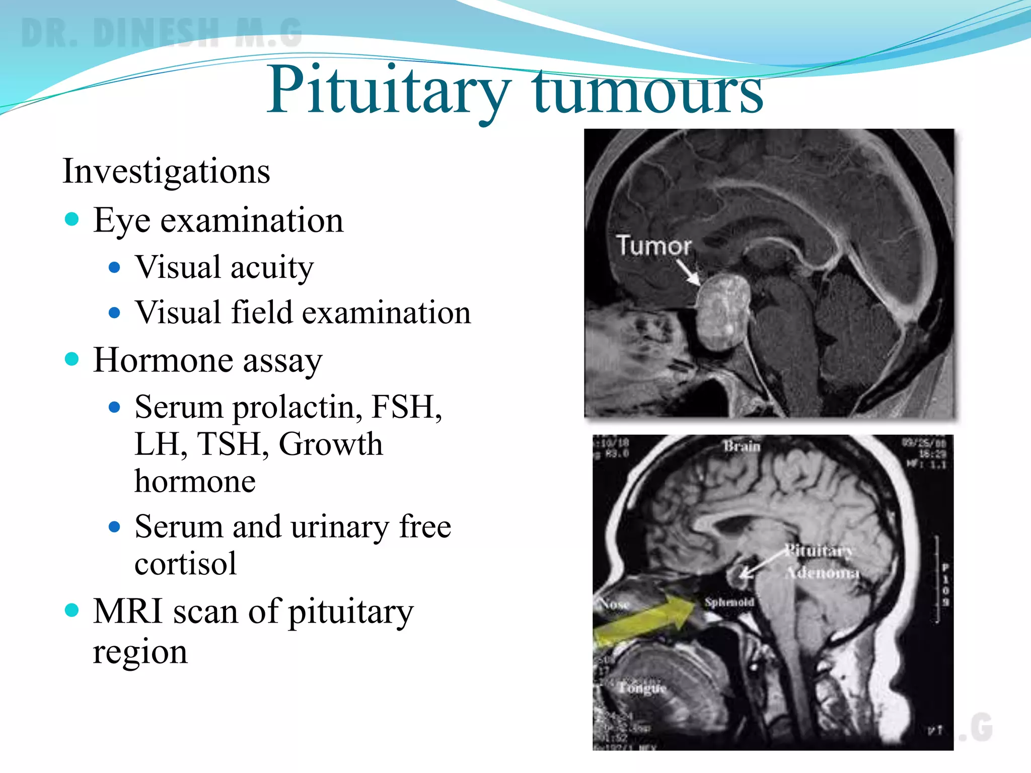 Pituitary gland | PPTX