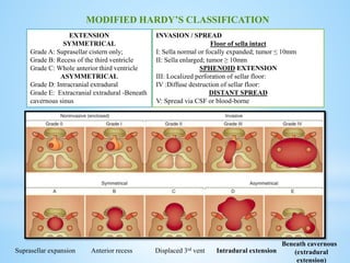 NEUROSURGICAL TENETS OF PITUITARY GLAND | PPTX
