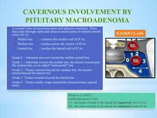 NEUROSURGICAL TENETS OF PITUITARY GLAND | PPTX