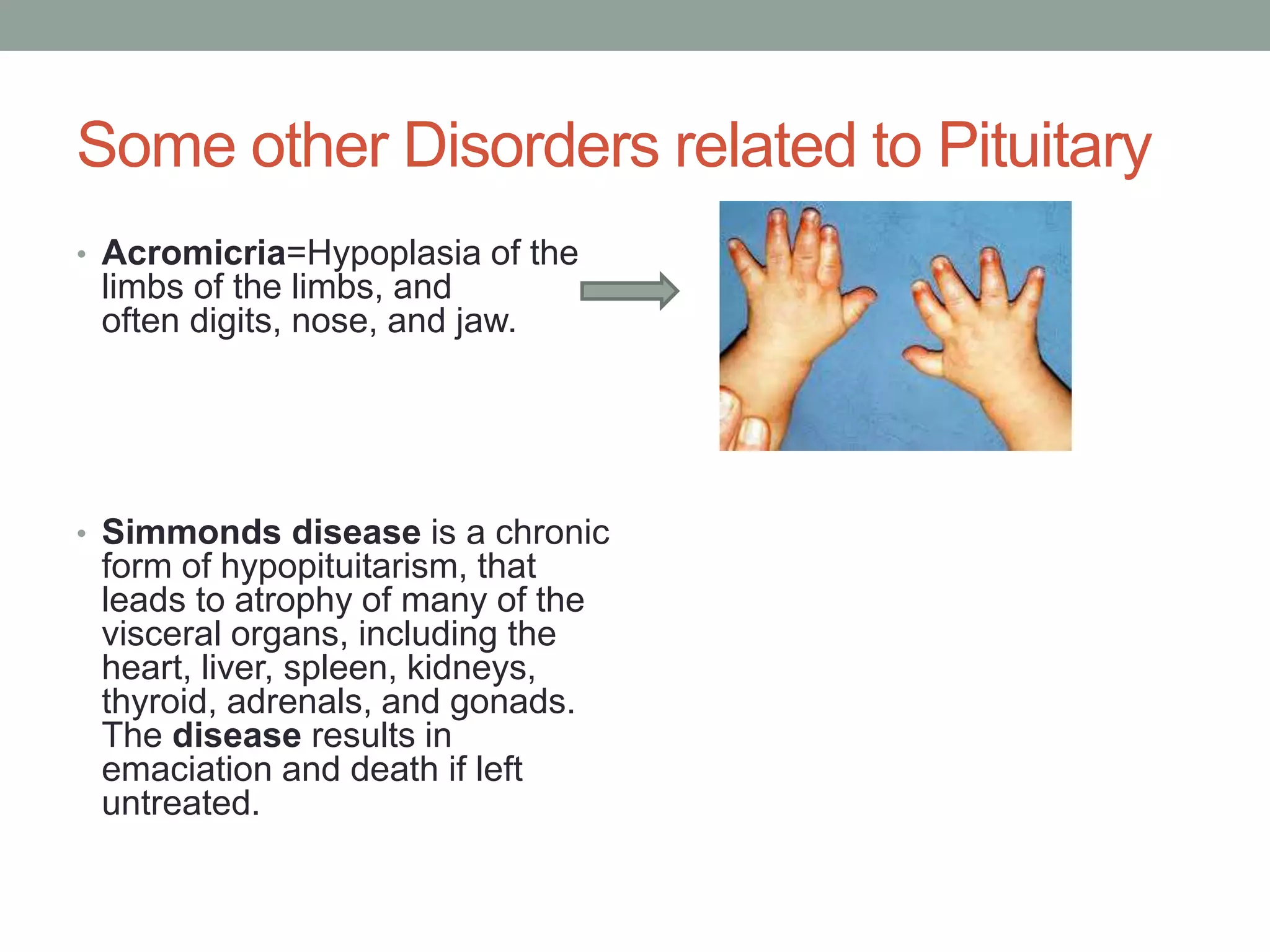 Pituitary gland disorders | PPTX