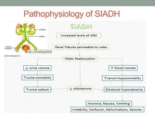 Pituitary gland disorders | PPTX
