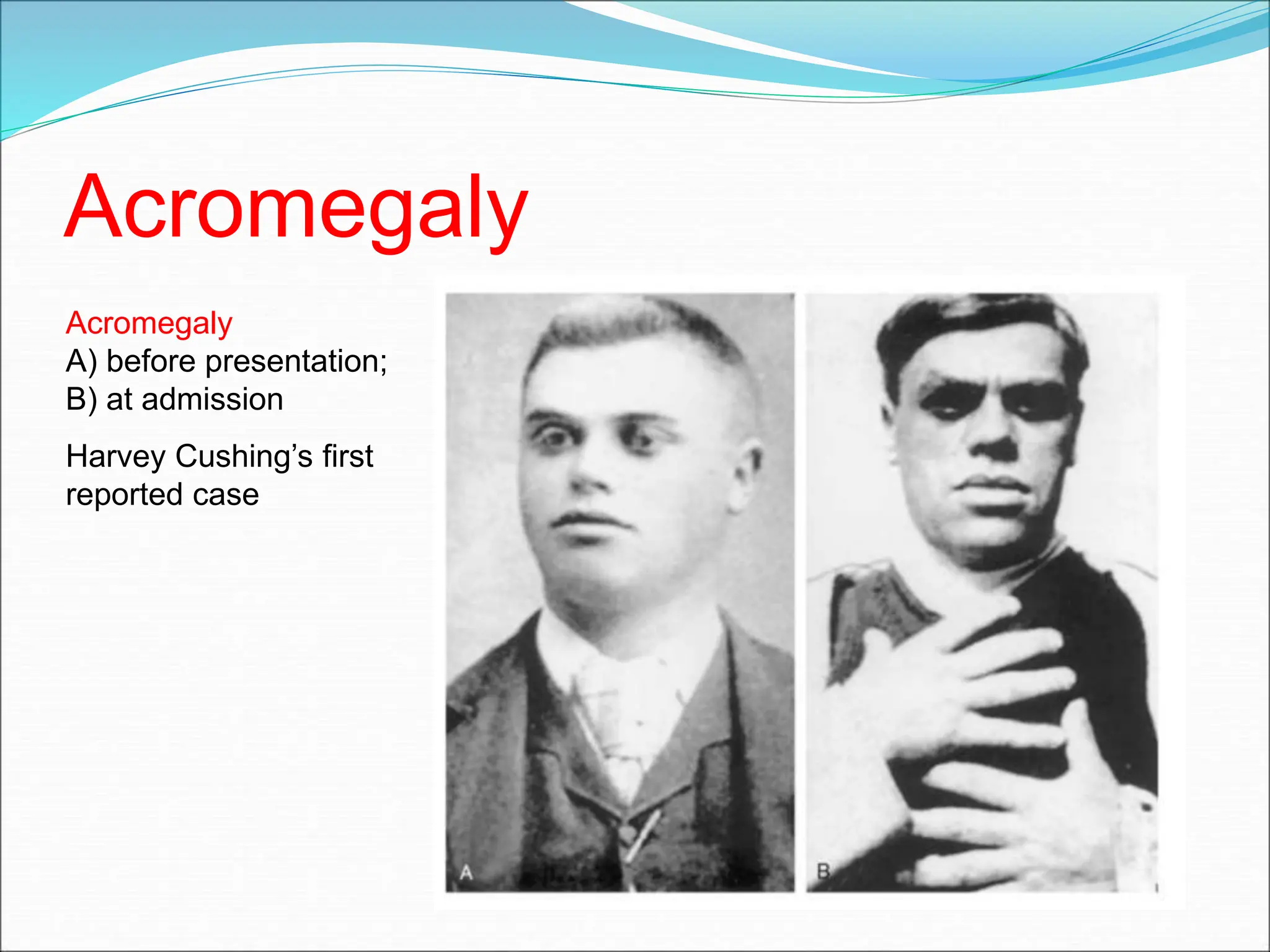 physiology of the human pituitary+gland.pptx