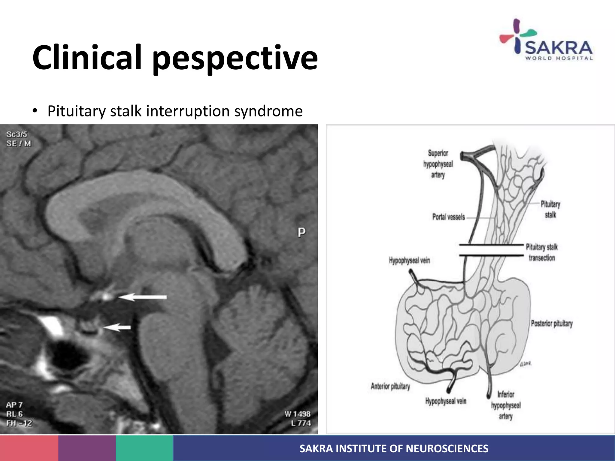 Anatomy of Pituitary | PPTX
