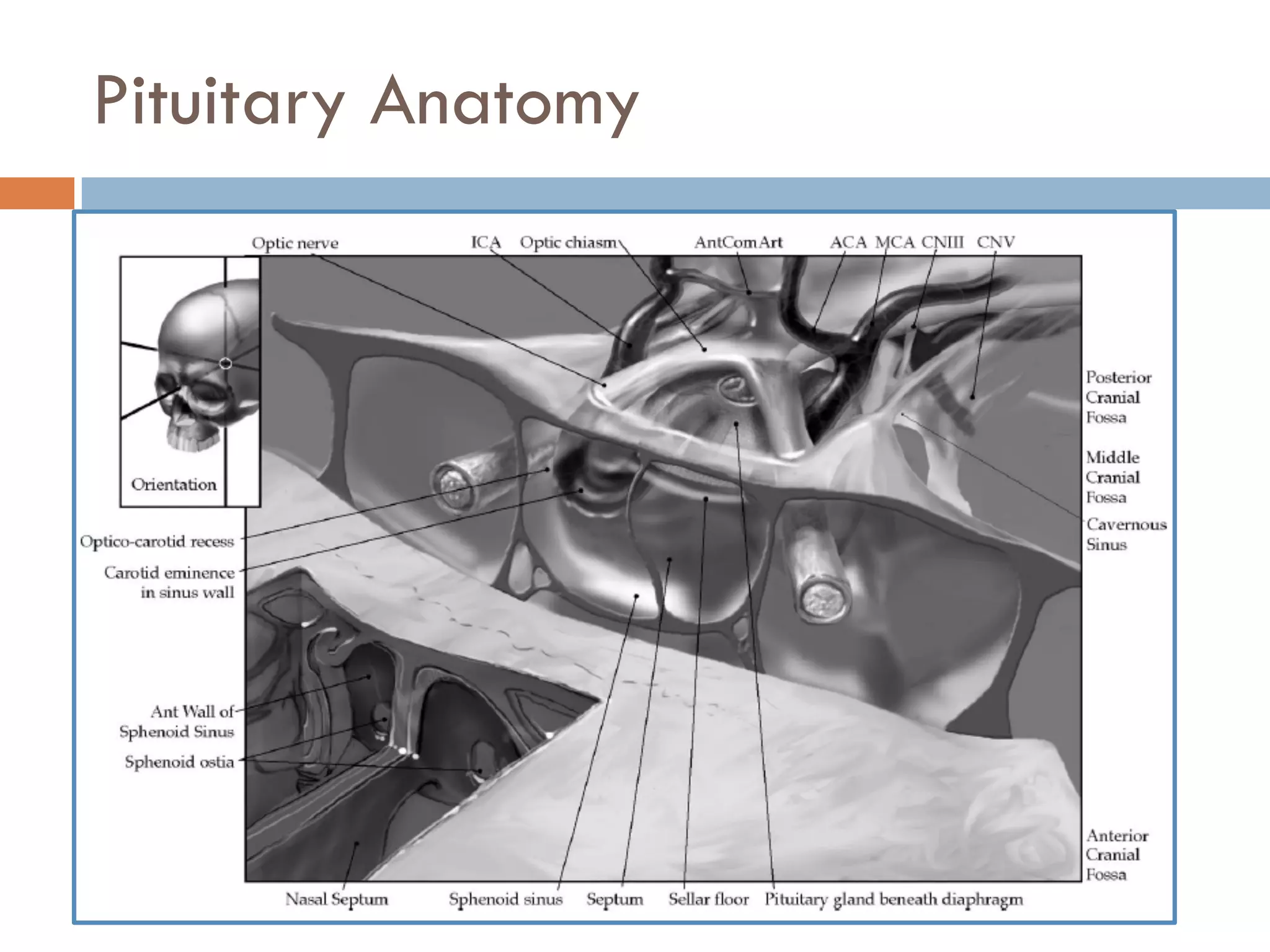 Edward Fohrman | Anesthesia for Pituitary Surgery | PDF