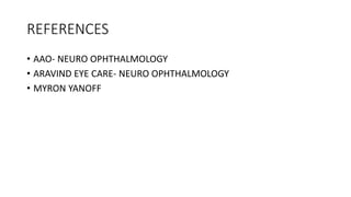 Pituitary tumors | PPTX