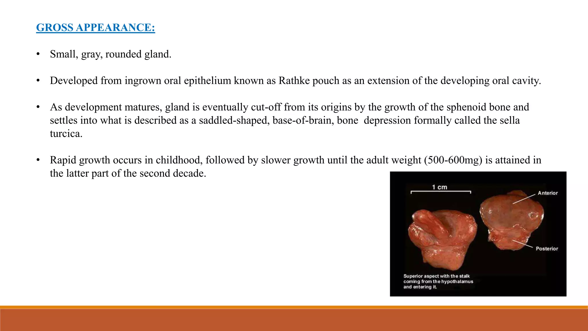 PITUITARY TUMORS.pptx