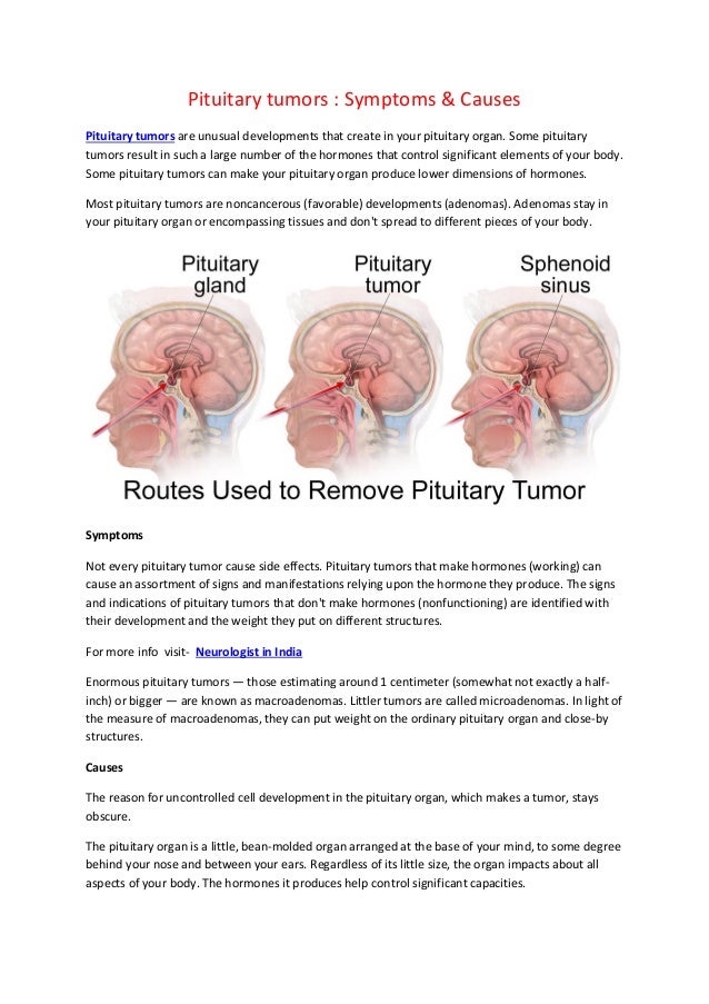 Pituitary tumors symptoms & causes
