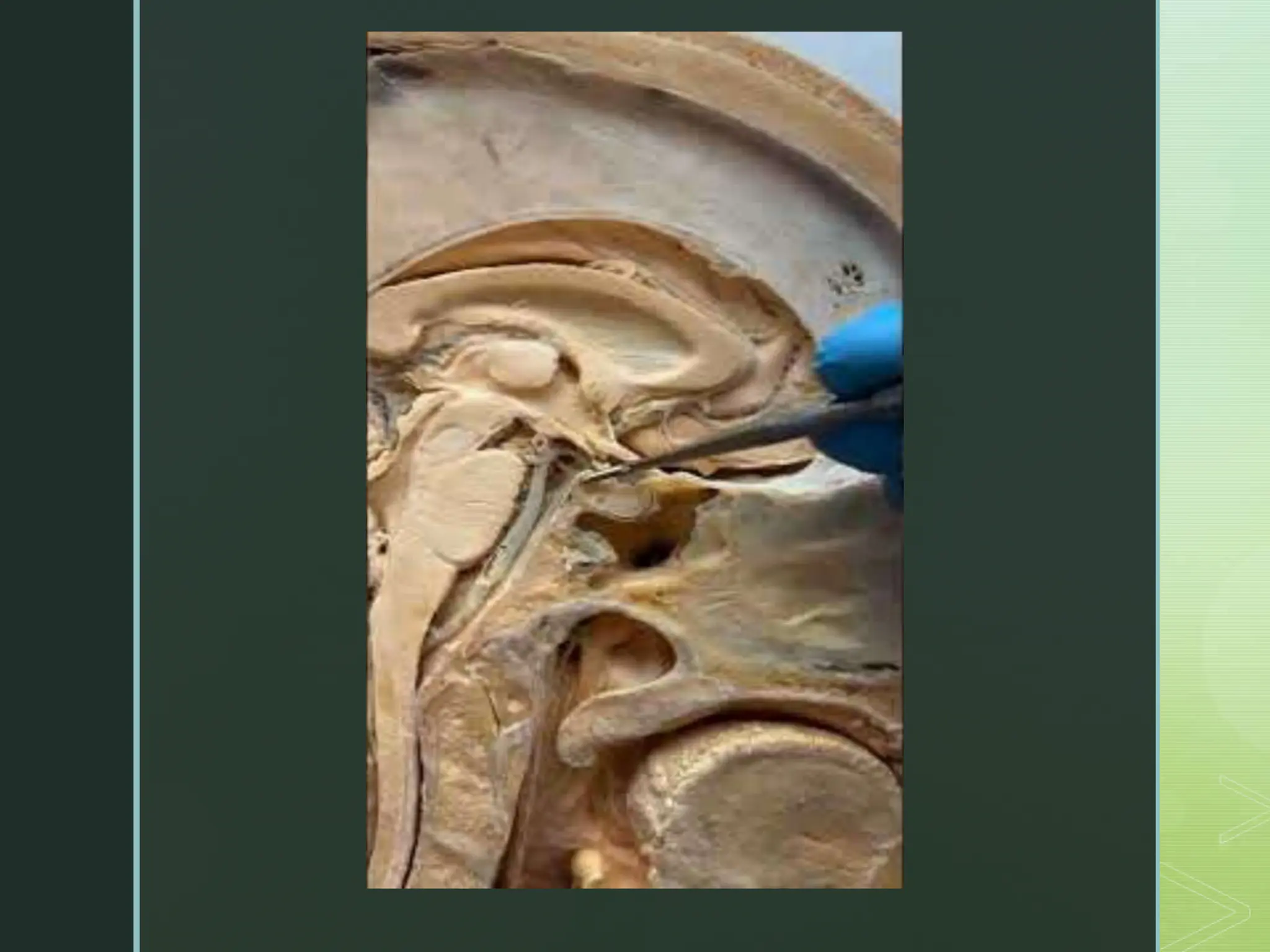 pitutary gland for students usedppt.pptx