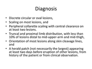 Pityriasis rosea | PPTX