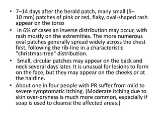 Pityriasis rosea | PPT