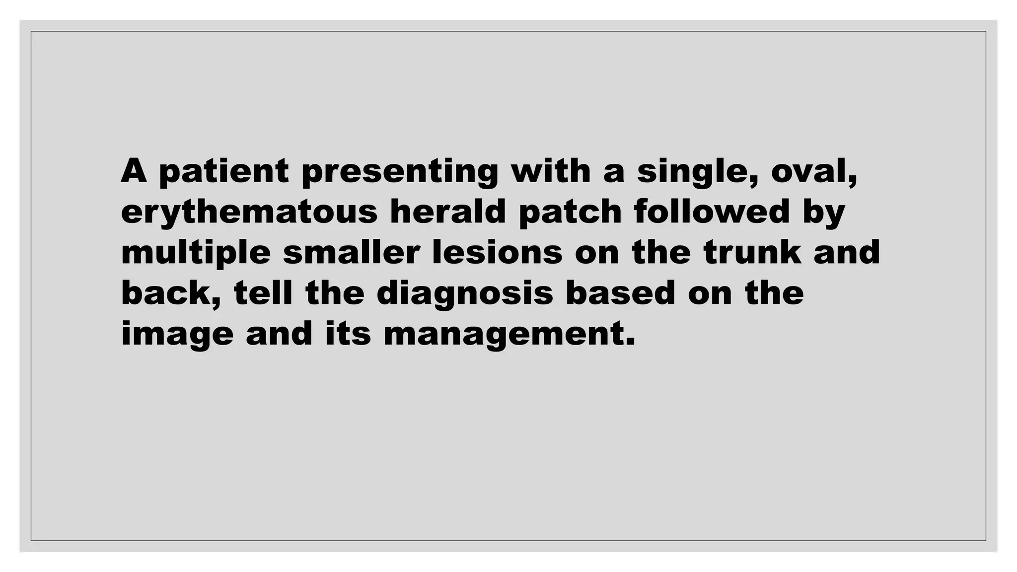 PITYRIASIS ROSEA CAUSES, MANAGEMENT.pptx