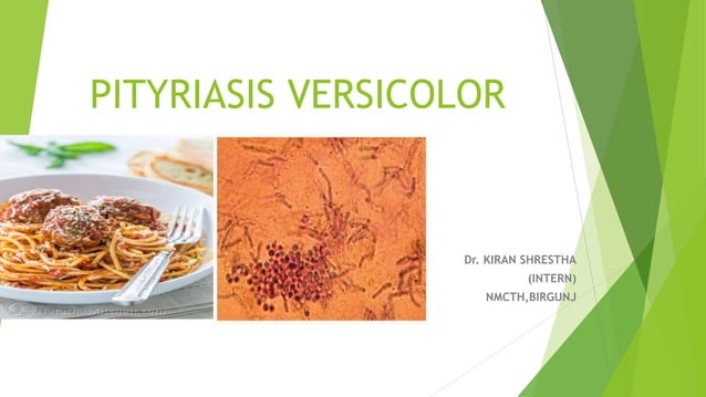 Pityriasis versicolor | PPTX | Skin and Dermatology | Diseases and ...