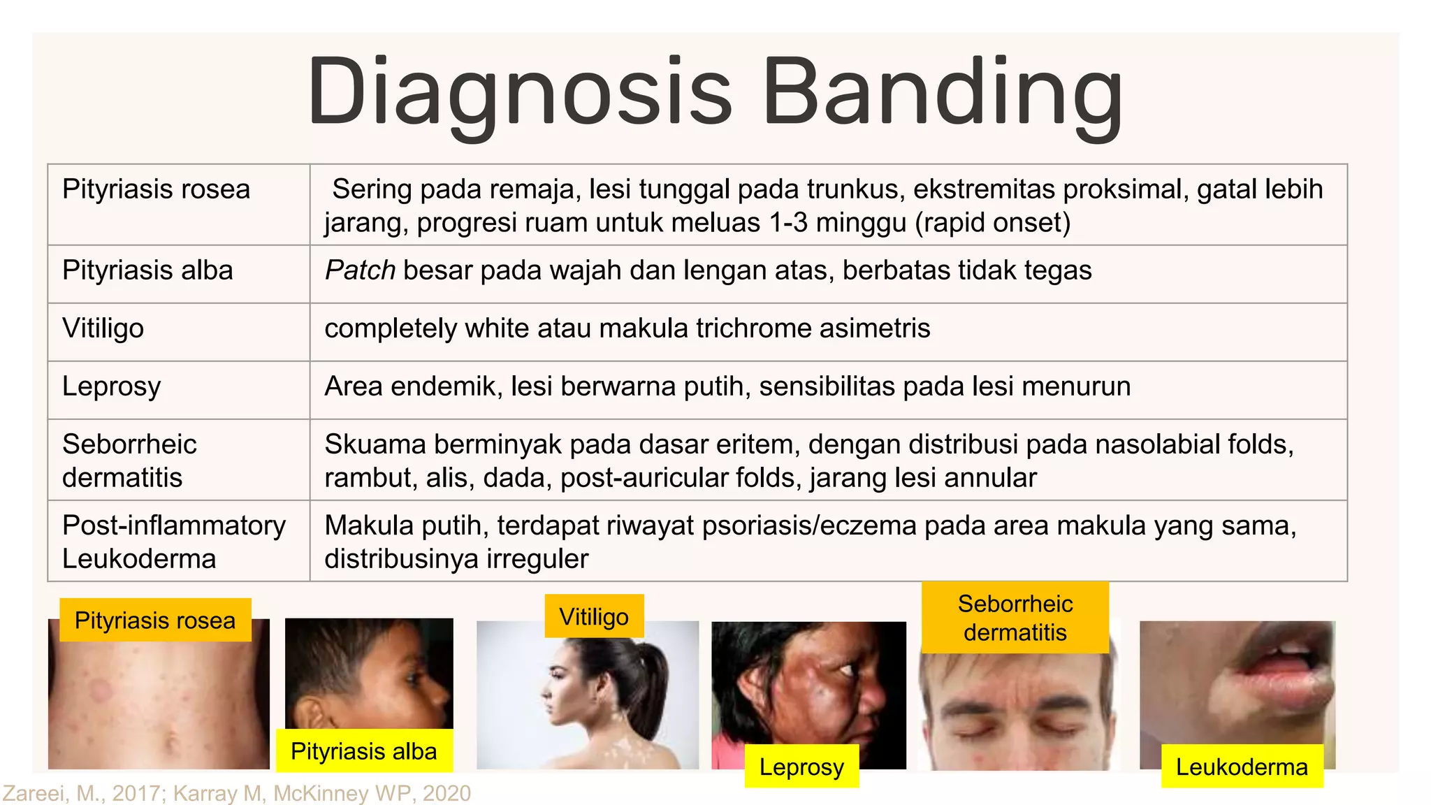 Laporan Kasus Tinea (Pityriasis) versicolor | PPTX