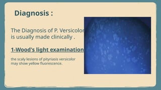 Pityriasis versicolor superficial fungal skin infection .pptx