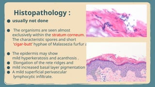 Pityriasis versicolor superficial fungal skin infection .pptx