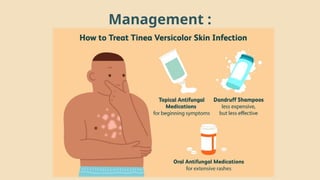 Pityriasis versicolor superficial fungal skin infection .pptx