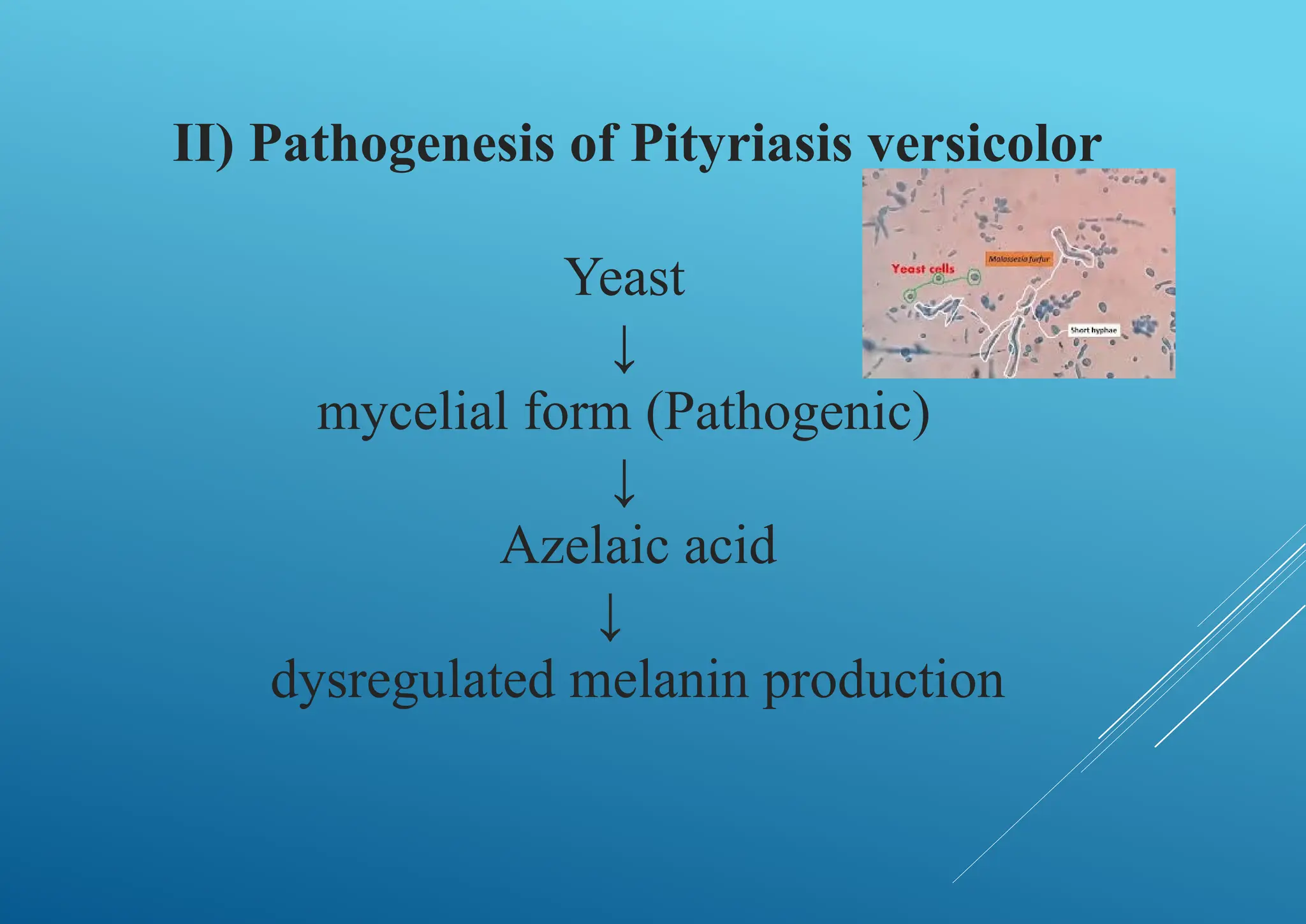 Pityriasis versicolor. For medical student | PPTX