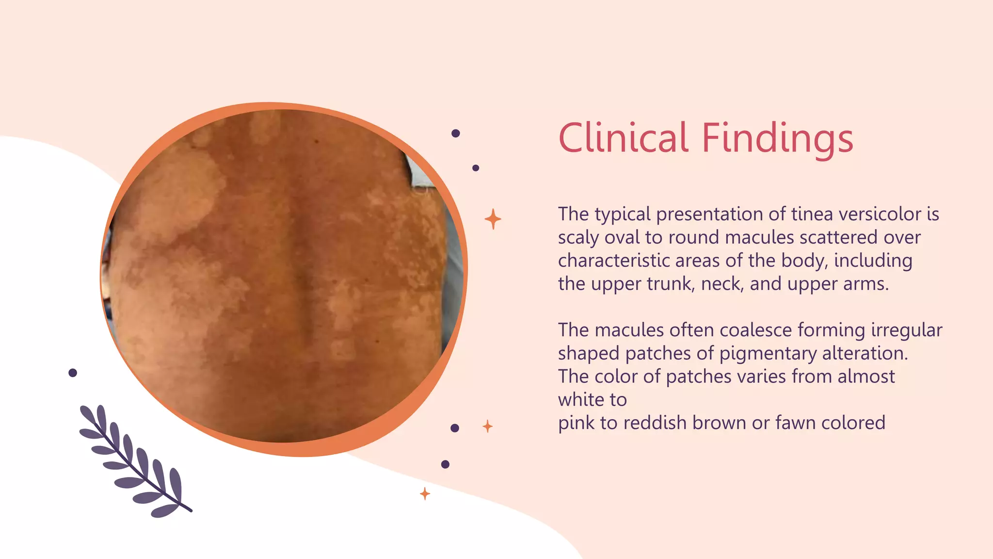 PITYRIASIS VESICULARIS.pptx