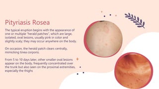 PITYRIASIS VESICULARIS.pptx