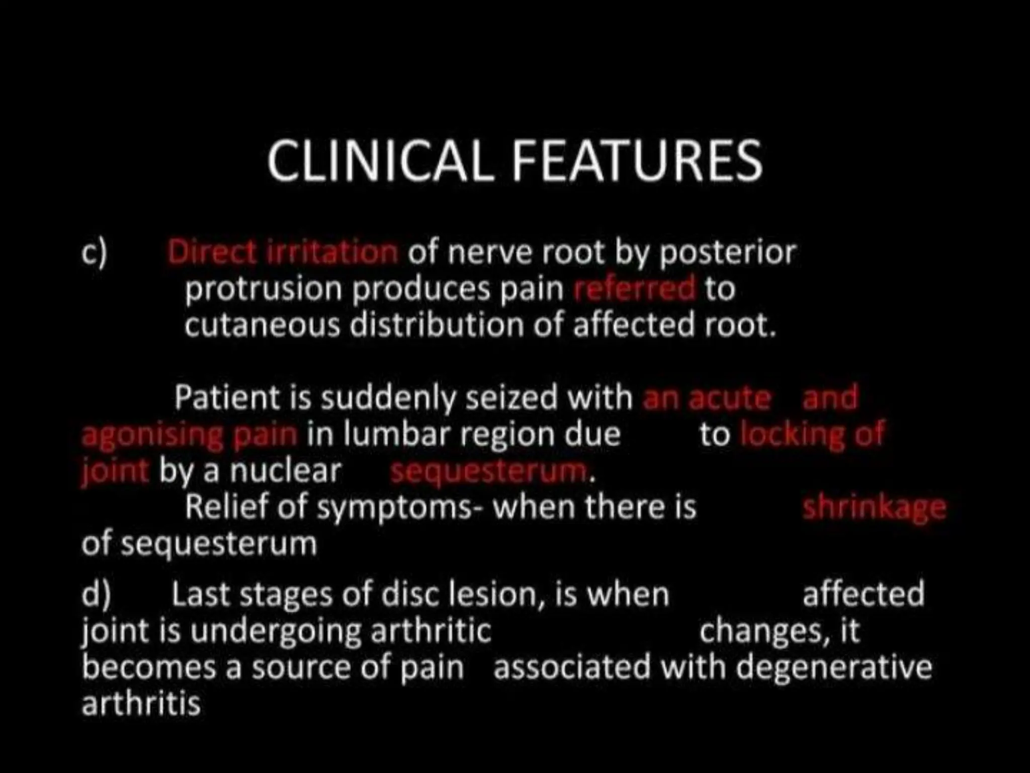 PIVD Prolapsed Intervertebral Disc | PPTX