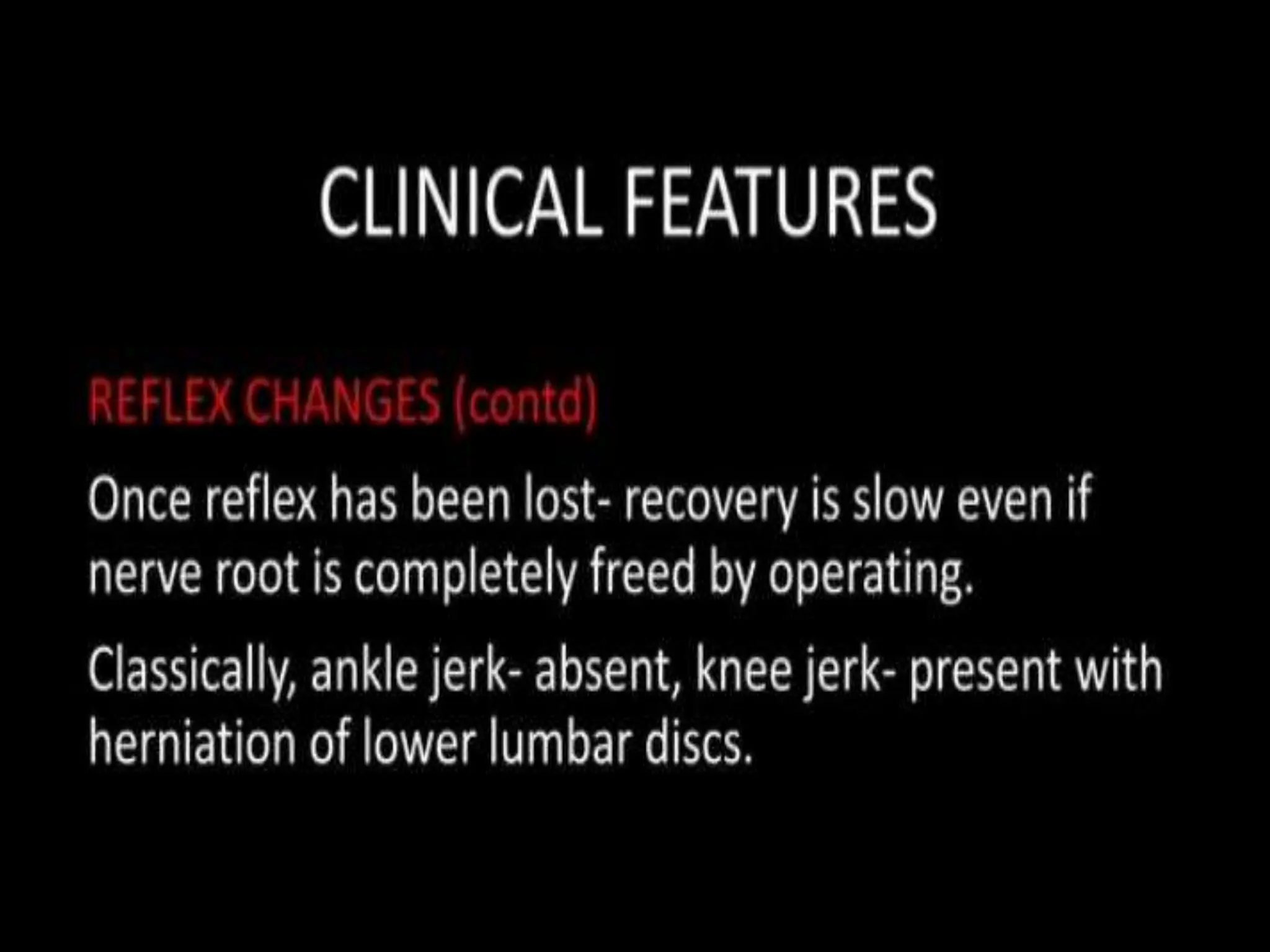 PIVD Prolapsed Intervertebral Disc | PPTX