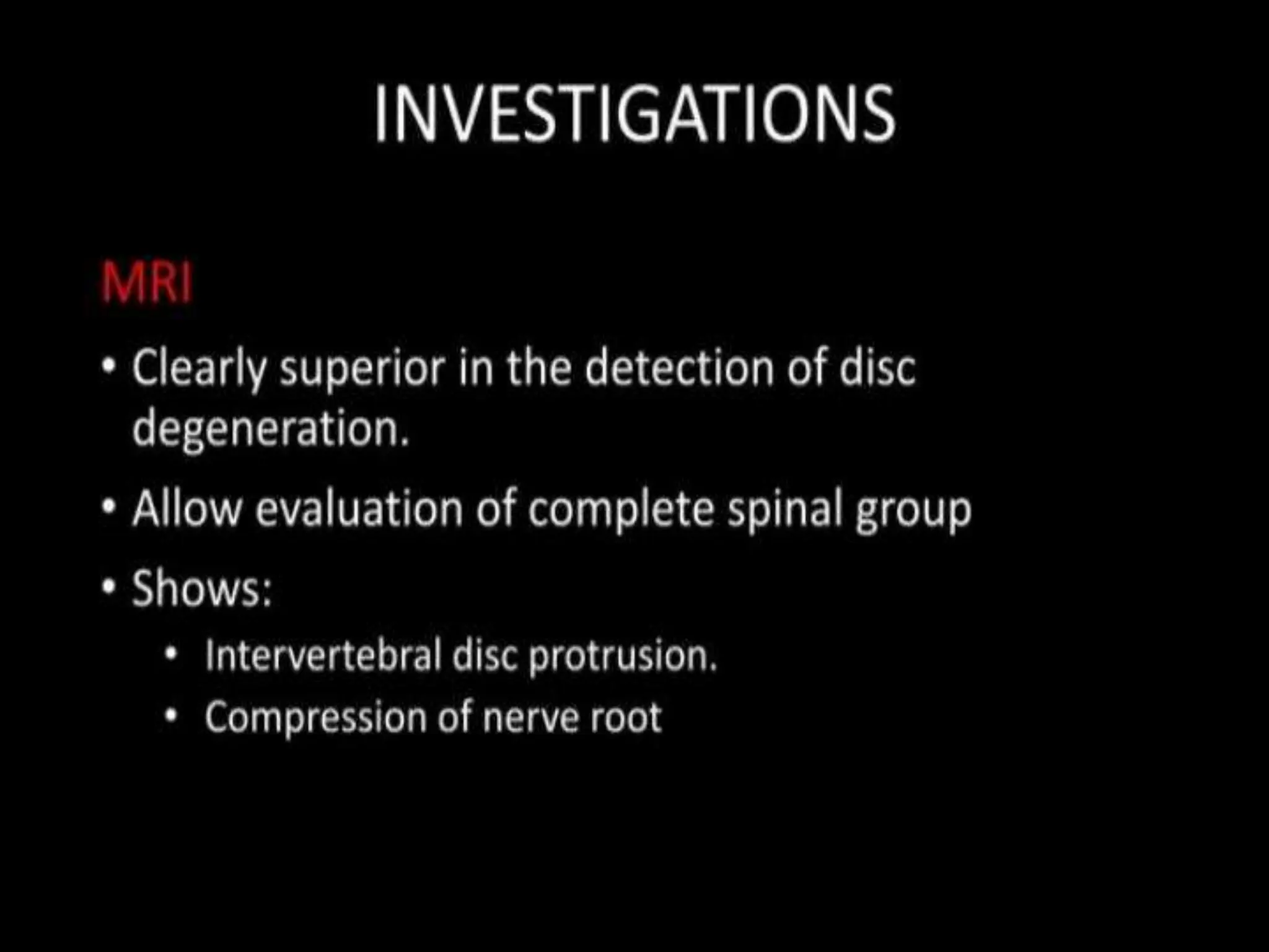 PIVD Prolapsed Intervertebral Disc | PPTX