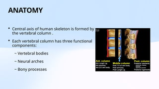 prolapsed intervertebral disc explanation | PPTX