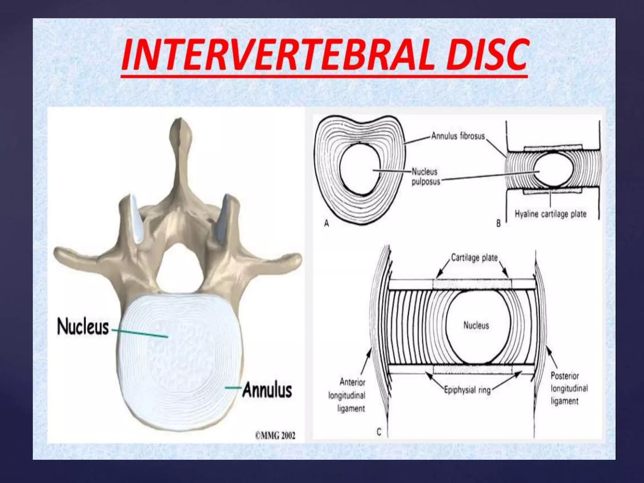 INTERVERTEBRAL DISC PROLAPSE (PIVD) | PPTX