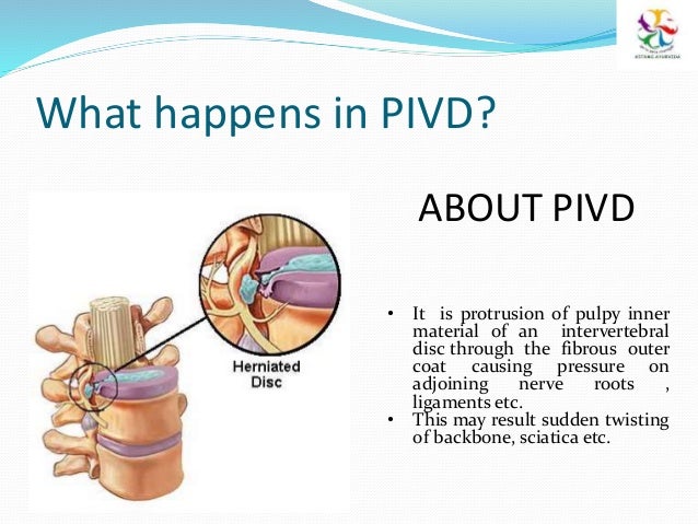 Dr Ambika Nayak Presented PIVD Management at International Ayurveda C…