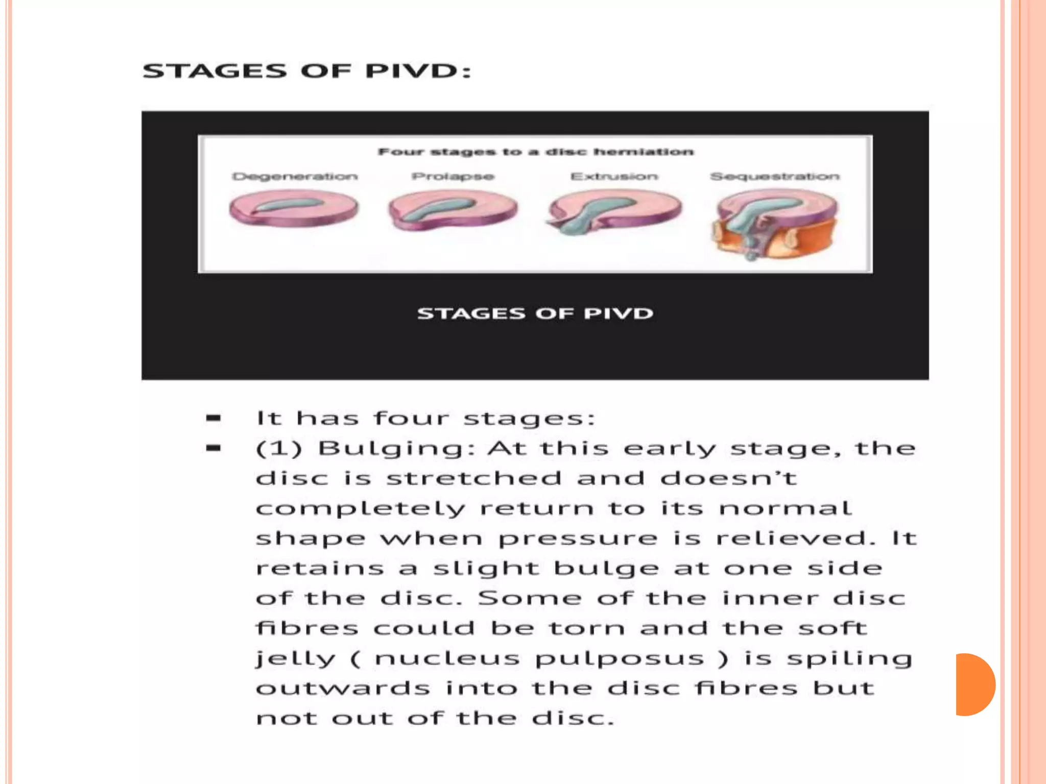 Pivd ppt | PPTX