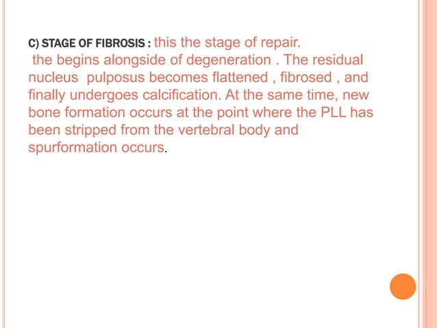 Pivd ppt | PPTX | Death, Injury, or Military Conflict | Sensitive Topics