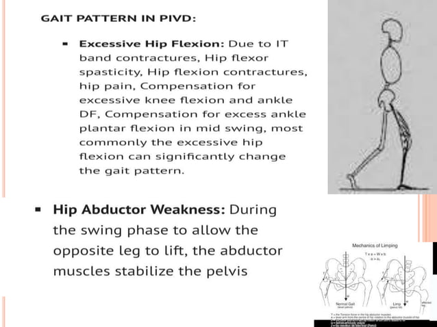Pivd ppt | PPTX | Death, Injury, or Military Conflict | Sensitive Topics