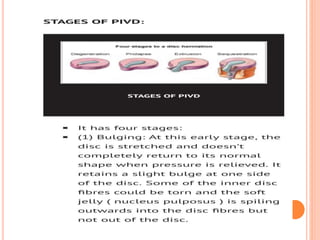 Pivd ppt | PPTX